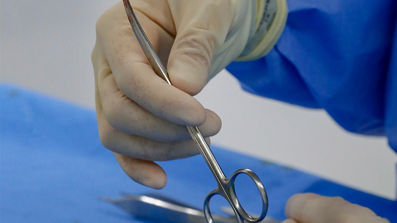 Man Vasectomized by Mistake